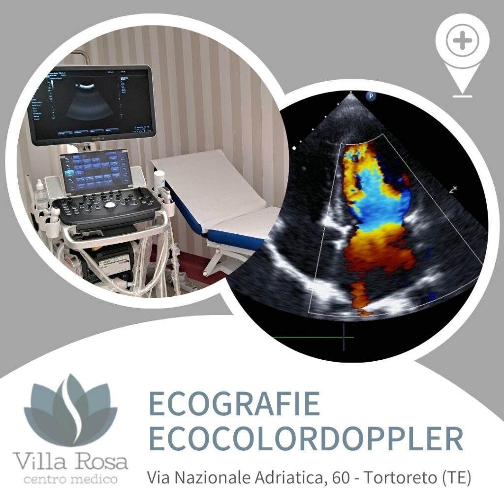 Ecografia Ecocolordoppler – Villa Rosa